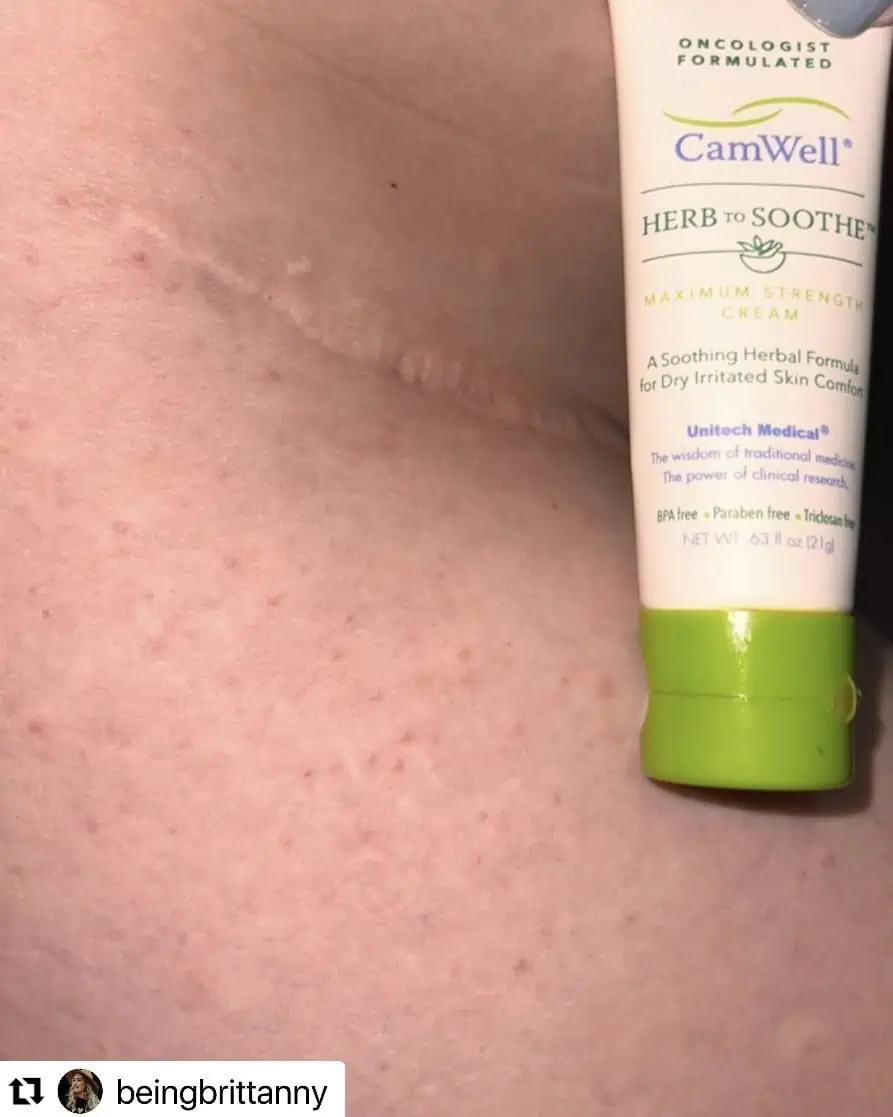 Oncology Skin Cream for Radiation Burns – Relief for Patients - CamWell